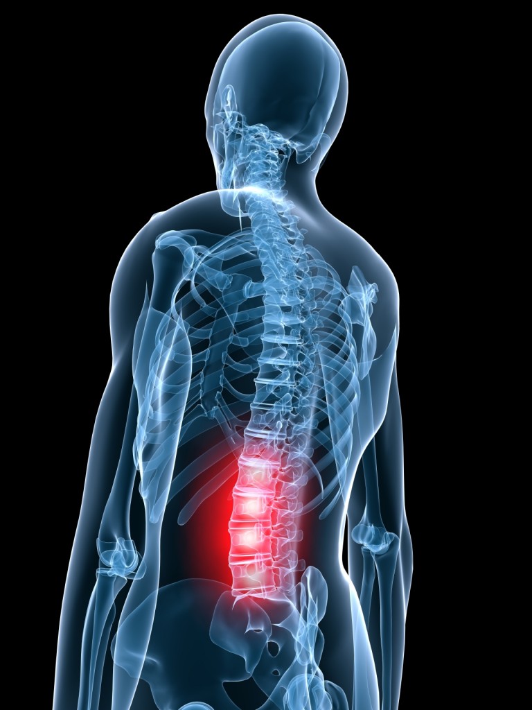 Facet Joint Injection - Austin Pain Relief